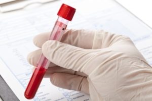 GH: ¿que es, para que sirve y como se hace? - Maestria Salud GH: ¿que es, para que sirve y como se hace? - Maestria Salud